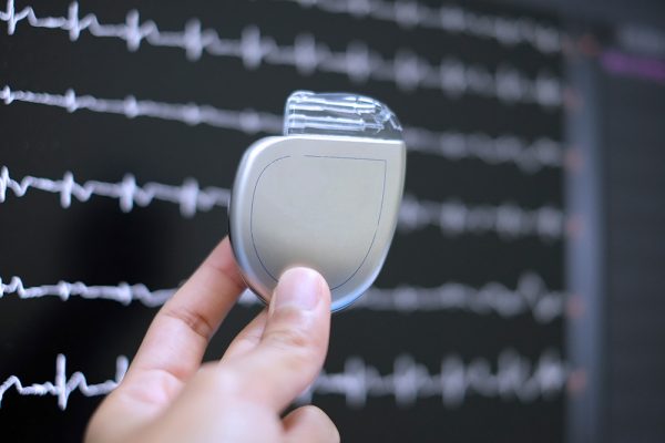 What Is a Defibrillator? | My Rhythm Device